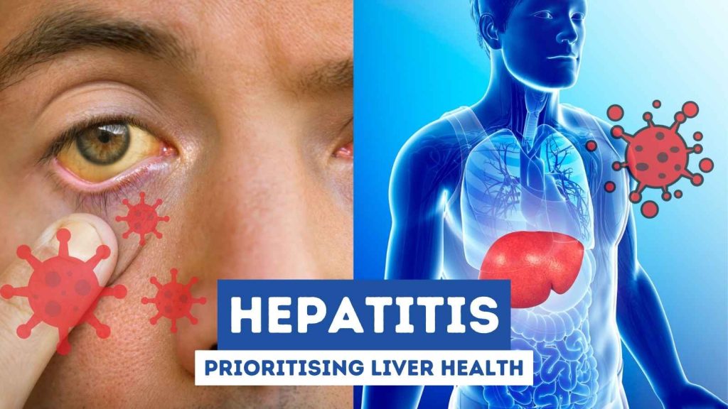 Hepatitis: Radang Hati yang Membuat Badan Menguning : Autonomicmaterials